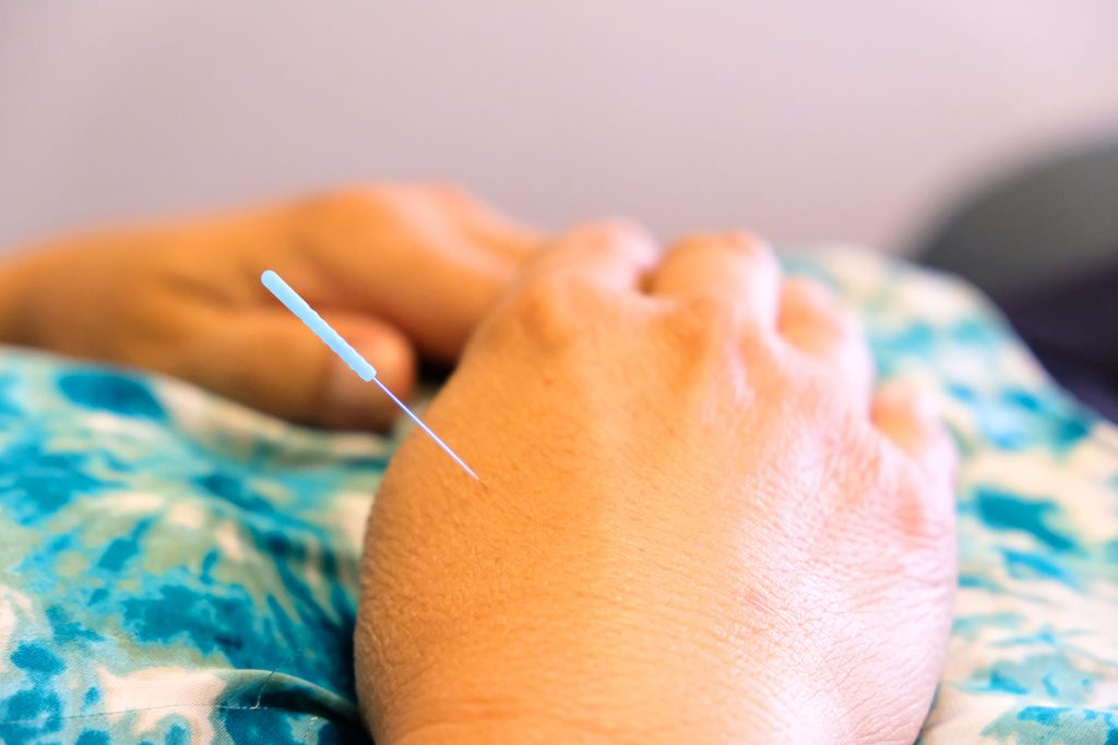 Acupuncture in Marin: First to practice acupuncture in Marin county ...